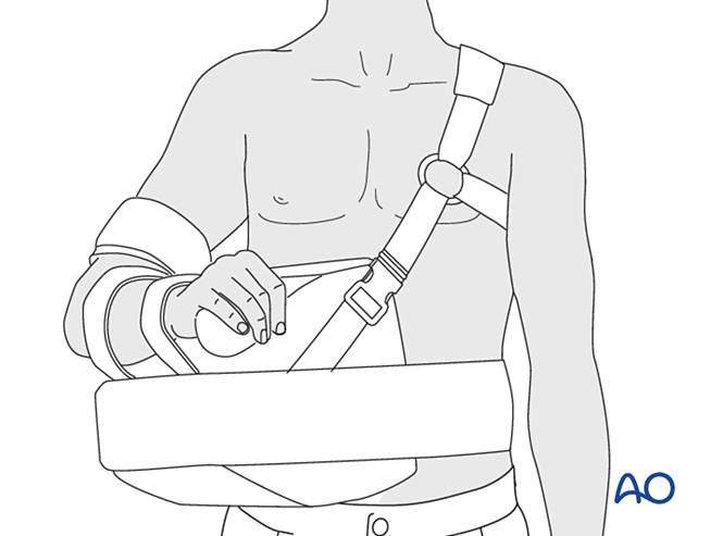 Nonoperative treatment for Body of the scapula
