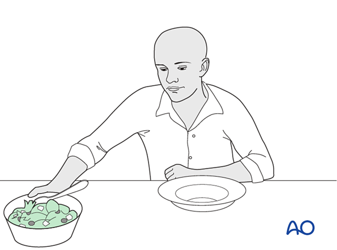 Nonoperative treatment for Avulsion of the lesser tuberosity