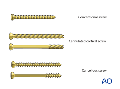 ORIF - Lag screw fixation for Avulsion of the acromion