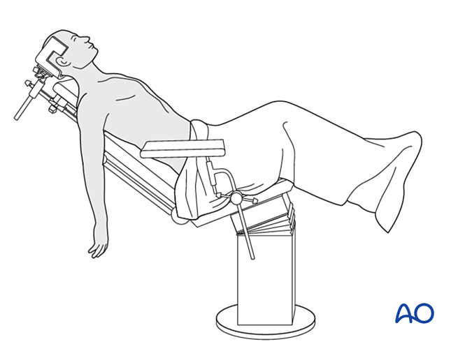 Beach chair position at 30º