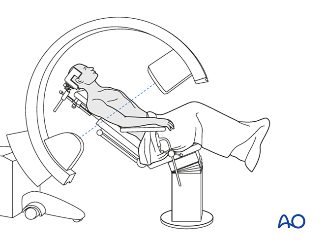 Beach chair position at 30º