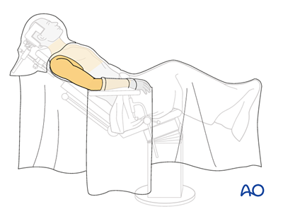 Beach chair position at 30º