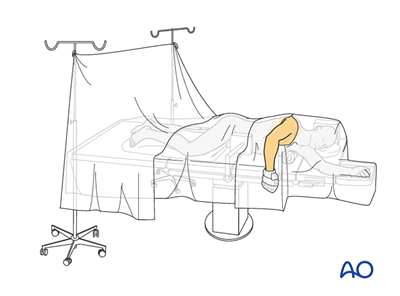 Lateral decubitus position