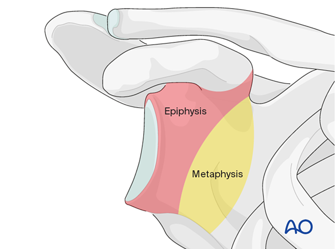 Shoulder implant configurations