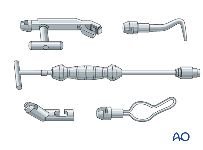 Femoral stem removal