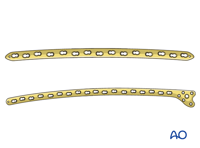 Compression plate and screw fixation for Fracture around the stem with ...