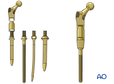Proximal femoral replacement for Fracture around the stem with an ...