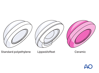 Polyethylene liner revision
