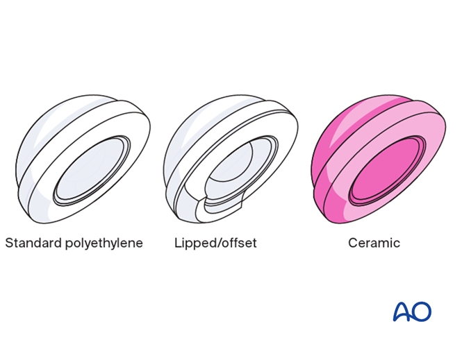 Polyethylene liner revision