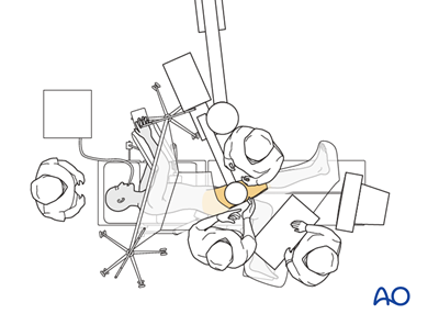 Lateral decubitus position
