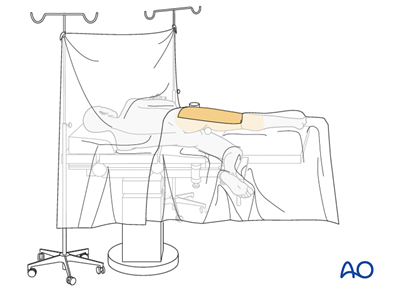 Lateral decubitus position
