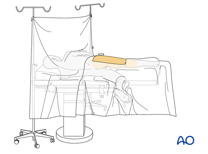 Lateral decubitus position