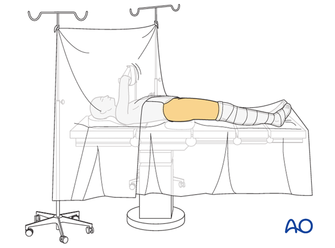 Direct anterior approach