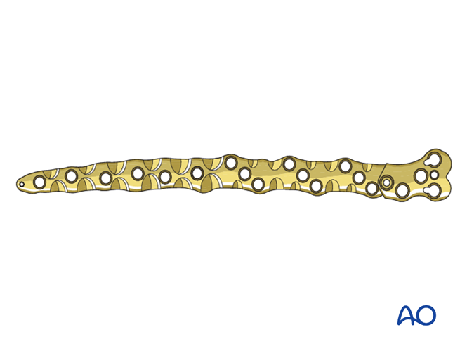 Adjunct plate options