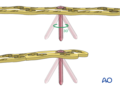 Adjunct plate options