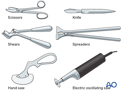 Splint or plaster for Fracture around a stable tibial component with ...