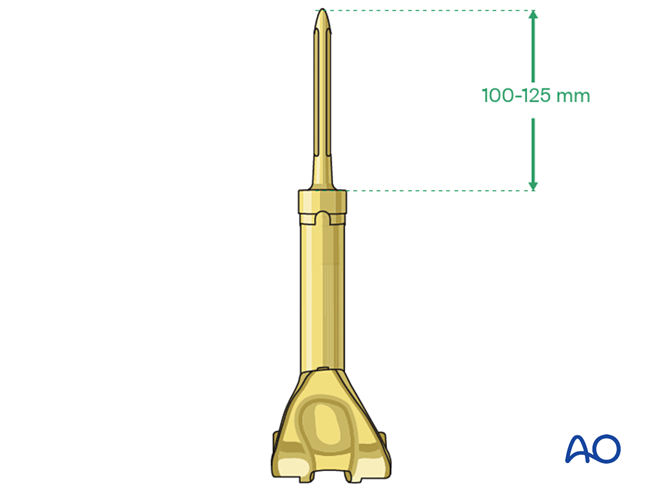Distal femoral replacement for Fracture around a loose femoral ...