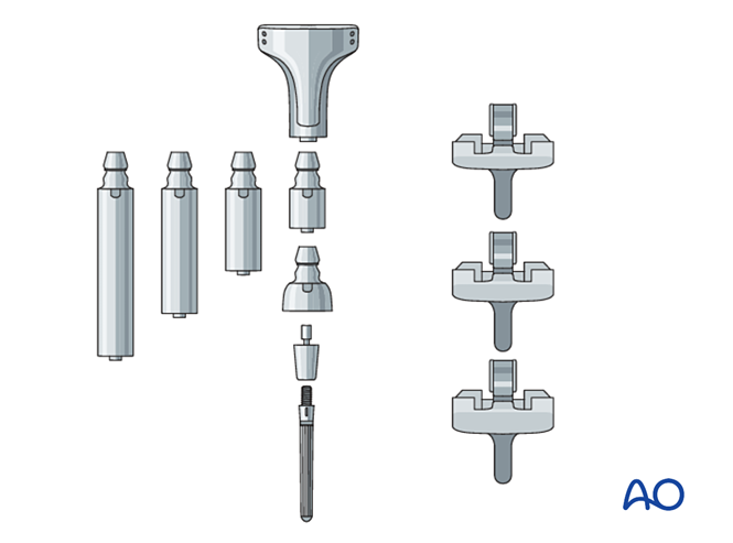 Proximal tibia replacement for Fracture around a loose tibial component ...