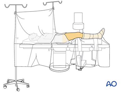 Supine position