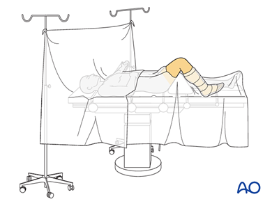 Supine position with knee flexed 90°