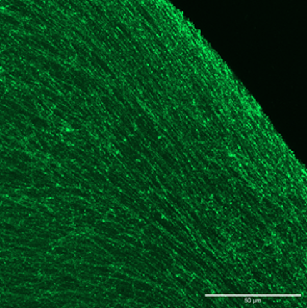 Multiple crosslinked bio-inks for 3D microextrusion of tissue-like ...