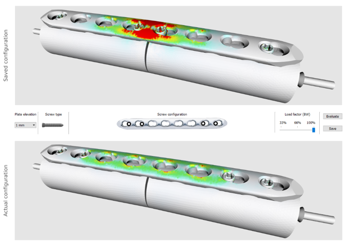 Virtual plate fixation of long bone fractures for educational purposes ...