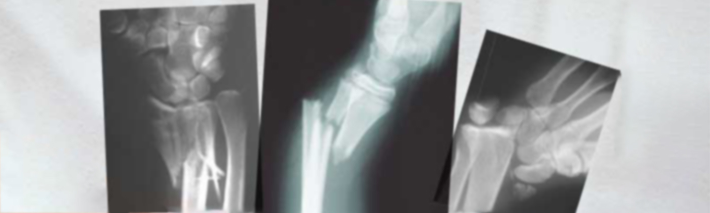 AO Trauma Hand North America