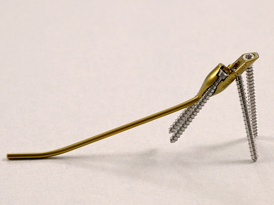 Distal Radius Intramedullary Nail (DRIM-Nail) for the fixation of ...