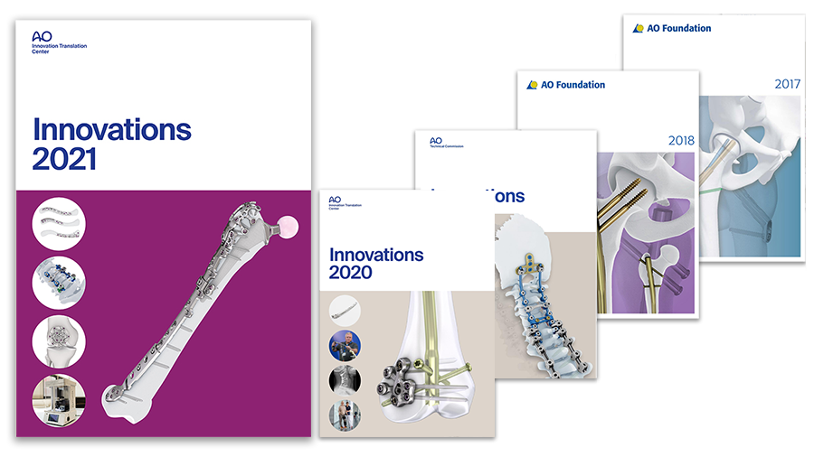 Stand-alone anterior interbody fusion with the Synfix Evolution