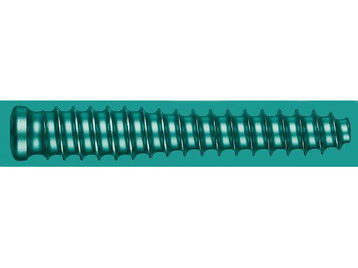 Anterior Telescoping Fixation System (TeleFix)