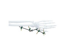 Small External Fixator