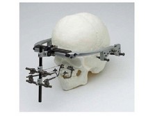 External midface distractor system