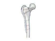 LCP Proximal Femoral Hook Plate 4.5