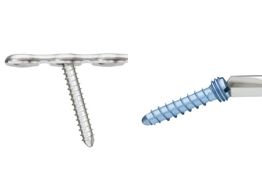 Matrix Mandible System