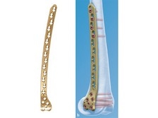 4.5 mm VA-LCP Curved Condylar Plate