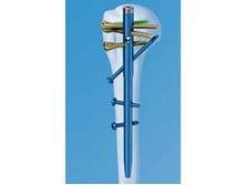 Long Nail - MultiLoc Humeral Nailing System