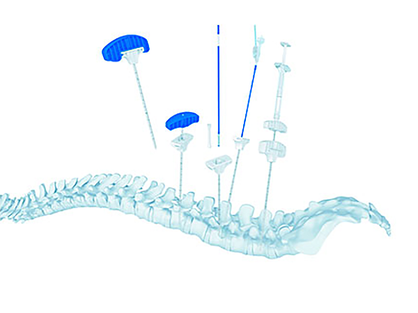 Synflate Vertebral Balloon System