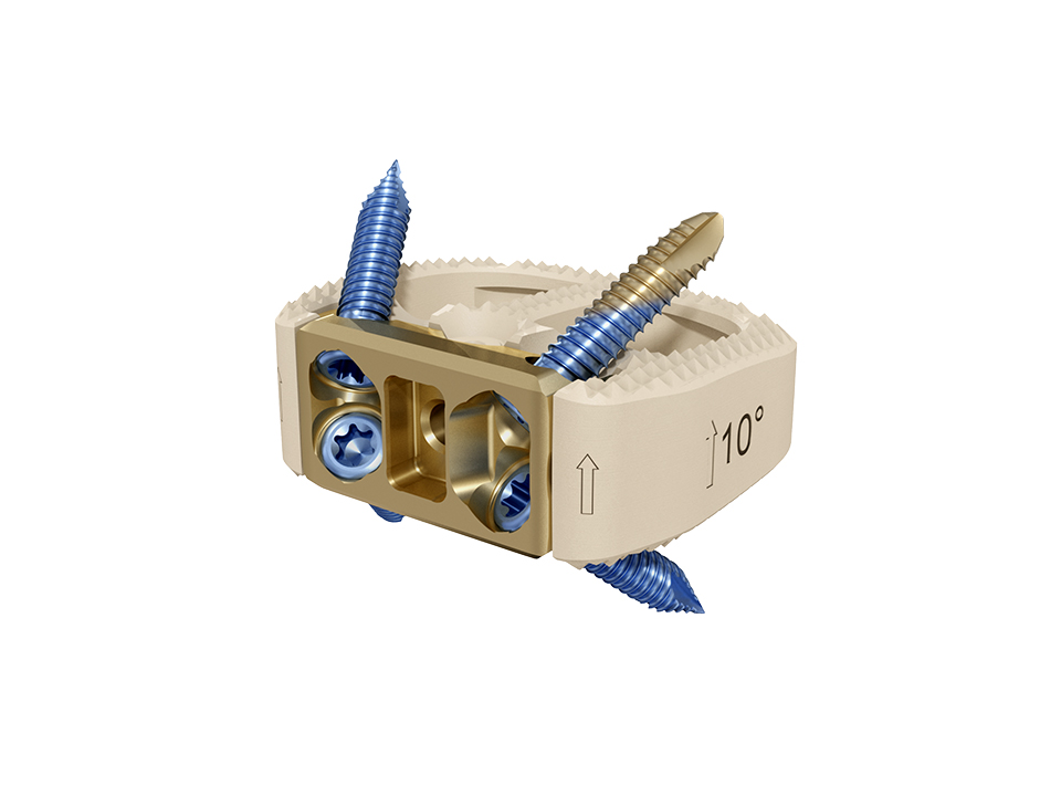 Stand-alone anterior interbody fusion with the Synfix Evolution