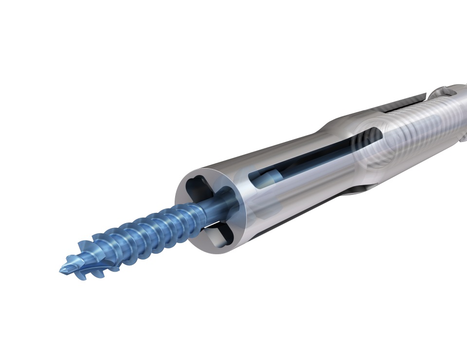 qisteaser.jpg?rev=f0ca122cbb30412c8d86553ee1e8d80e