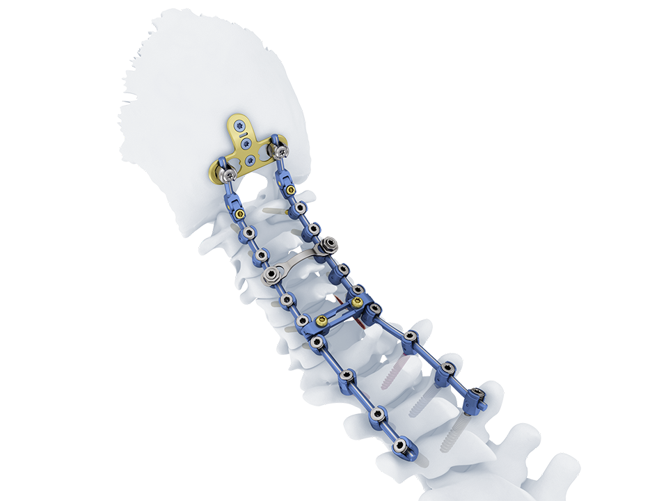 Symphony Occipito-Cervico-Thoracic System