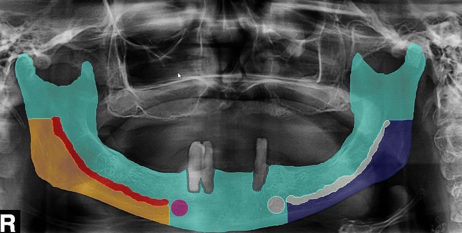 AO CMF Preclinical Research Projects