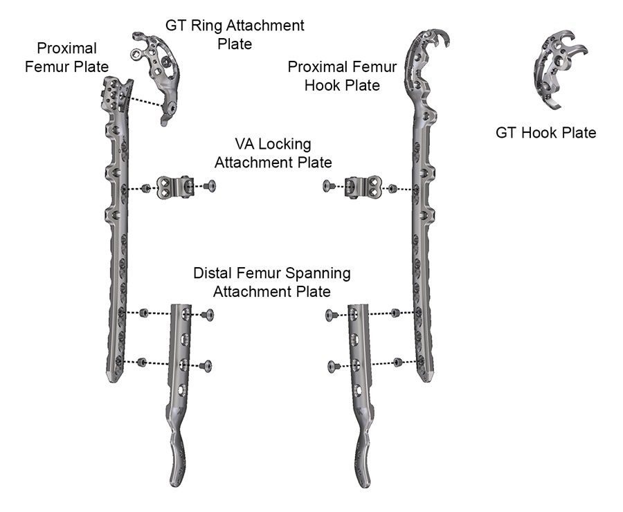 The new Variable Angle LCP Periprosthetic Proximal Femur Plating System