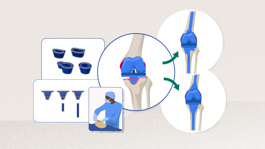 Surgical Technique Of Metaphyseal Sleeves And Cones