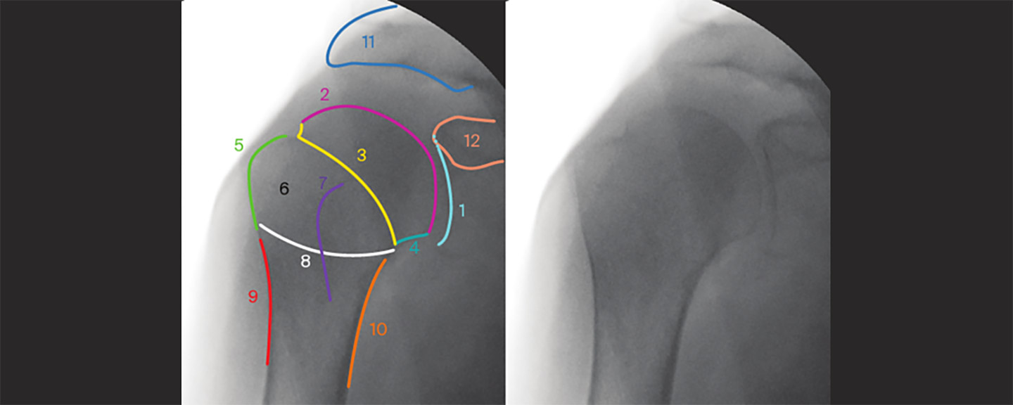Ao Traumas Surgery Référence – AO Surgery Reference – GLSHVL
