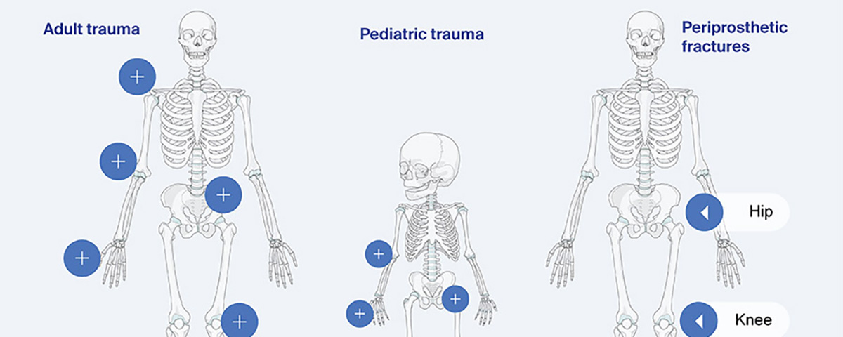 AO Trauma Switzerland